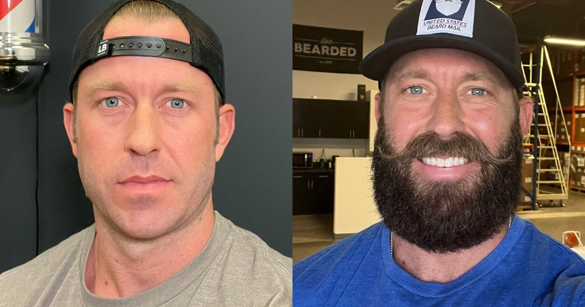 The Ultimate Beard Growth Secrets Revealed – Live Bearded