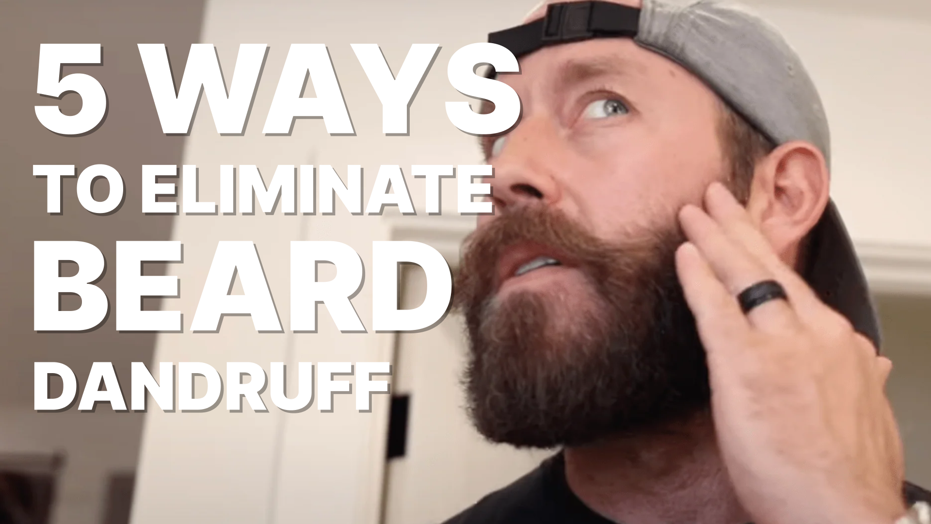 5 Ways to Eliminate Beard Dandruff – Live Bearded